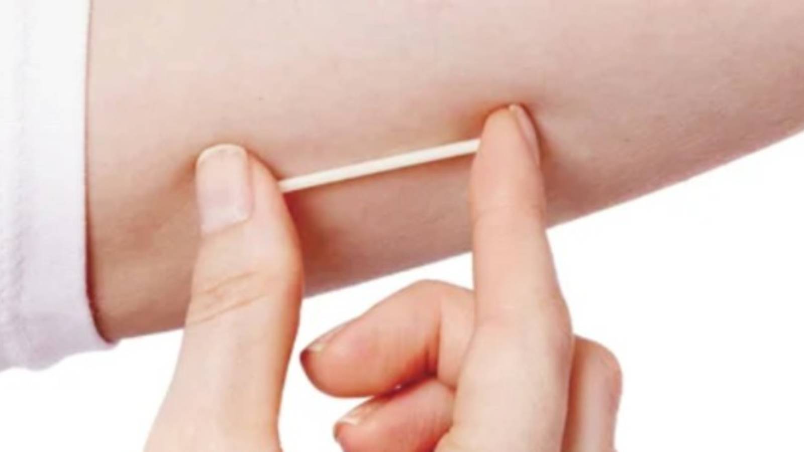 Implante contraceptivo hormonal será oferecido pelo SUS